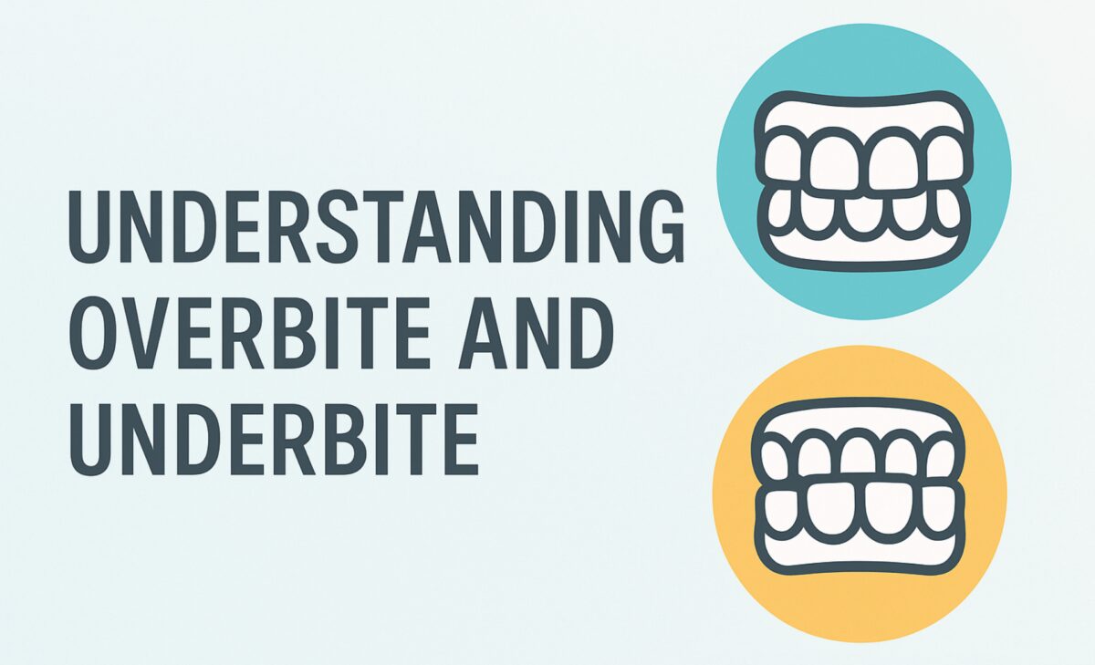 Differences between Overbite & Underbite | Treatment Options