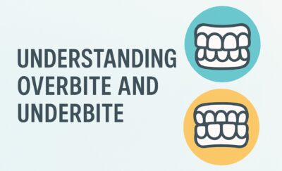 Differences between Overbite & Underbite | Treatment Options