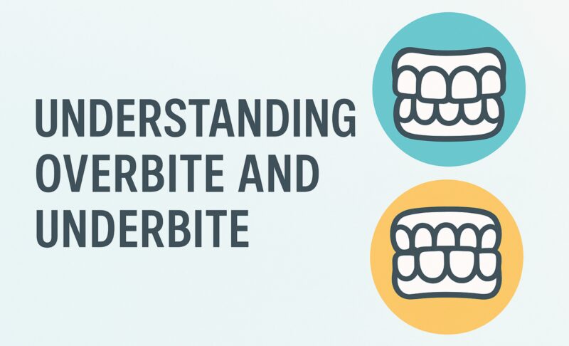 Differences between Overbite & Underbite | Treatment Options